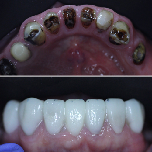Dentist Pretam Gharat performs life changing full mouth rehabilitation